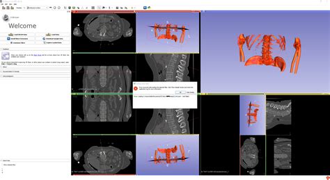 Error Loading A Saved Scene Support 3d Slicer Community