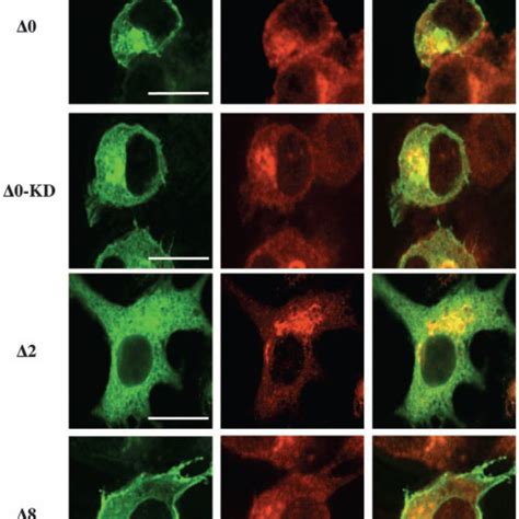 Intracellular Trafficking Of Trka Gfp Fusion Proteins Download