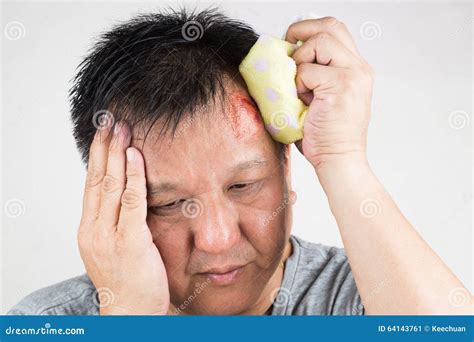 Swollen Injured Male Limb On The Left Foot With Hematoma When A Heavy