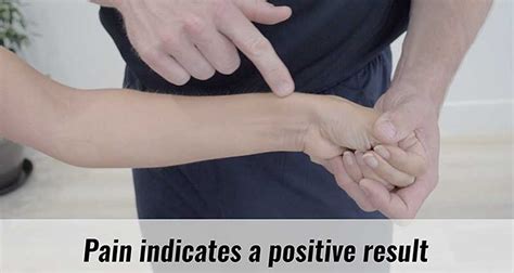 Tinels Test Wrist For Carpal Tunnel Syndrome