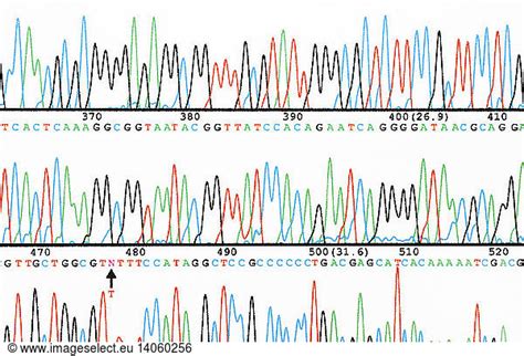 Dna Sequencing Dna Sequencing Chromatogram Deoxyribonucleic Acid Hgp Margaret Sanger Slee