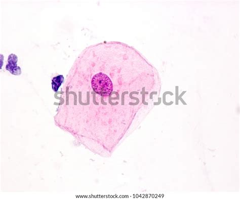 459 Resultados De Imágenes Fotos De Stock E Ilustraciones Libres De Regalías Para Squamous