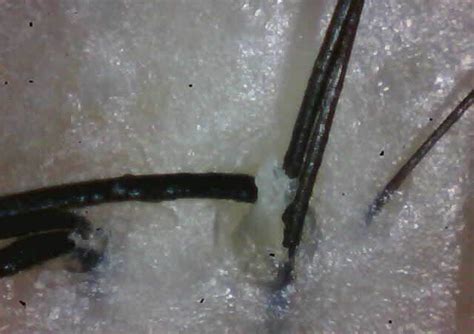 5 Warning Signs Your Scalp Is In Trouble