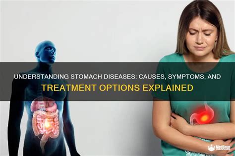 Understanding Stomach Diseases Causes Symptoms And Treatment Options