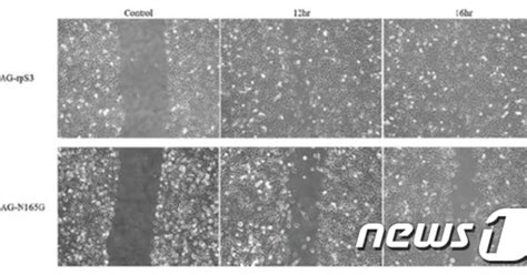 암 세포 악성 정도와 전이를 조기에 확인할 수 있는 단백질 발견