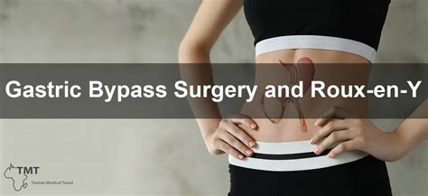 Roux En Y Gastric Bypass Weight Loss And Recovery Guide