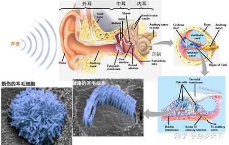 噪音对健康的危害究竟有多大？ 知乎