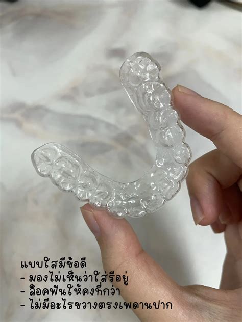รีเทนเนอร์แบบลวดvsแบบใส แบบไหนดีกว่า 🦷 แกลเลอรีที่โพสต์โดย Lamhabb Lemon8