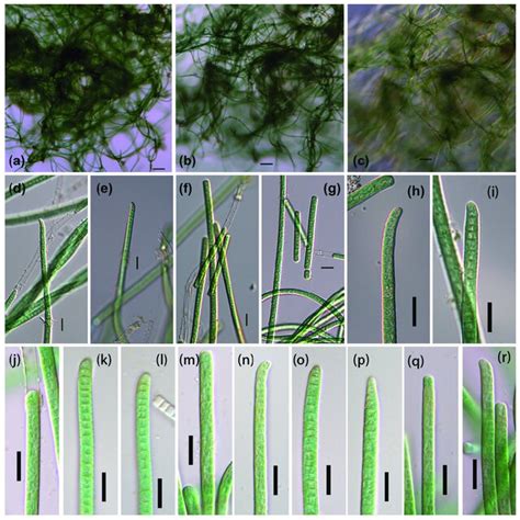 Light Microscopy Of Phormidium Like Sp 2 Strains A C Represent