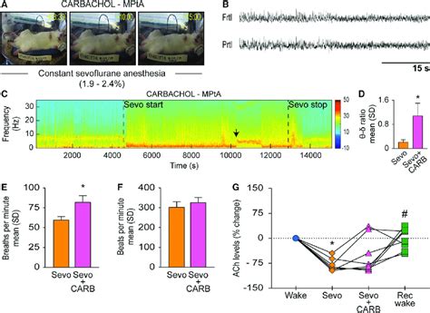 Cholinergic Stimulation Of Medial Parietal Association Cortex In Download Scientific Diagram
