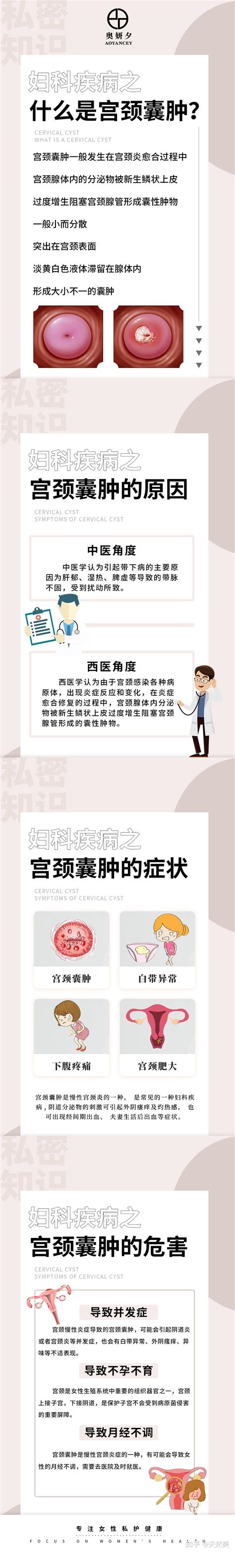 关于宫颈囊肿看完这一篇你就知道了 知乎