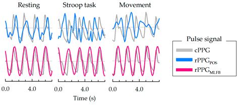 Improved Remote Photoplethysmography Using Machine Learning Based Filter Bank