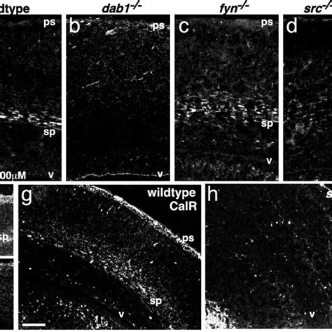 The Src Fyn Mutant Shows Defects In Preplate Splitting A B Cspg Download Scientific Diagram