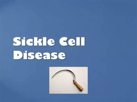 PPT Sickle Cell Disease PowerPoint Presentation Free Download ID