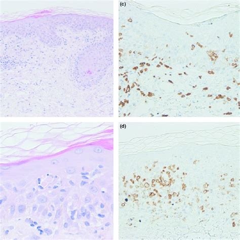 Overview Of The Difference Between Agglomerative And Divisive Download Scientific Diagram