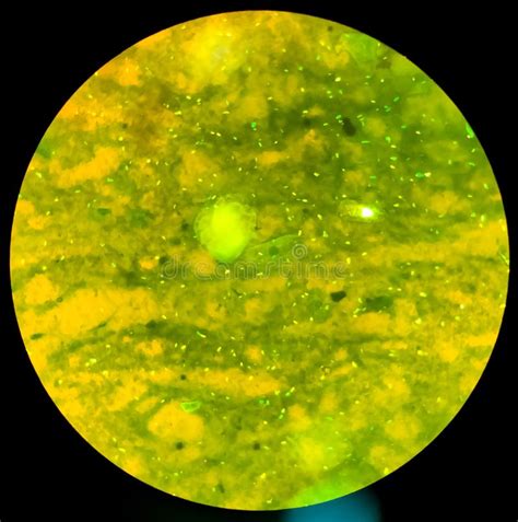 Microbacterium Tuberculosis Bacteria Mtb Stock Image Image Of Skin Phlegm 280866909