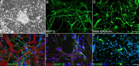 Differentiation Of HiPSCs Into Neurons And Astrocytes Representative