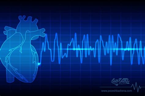 دستگاه ضربان ساز قلب قیمت ضربان ساز قلب انواع پیس میکر