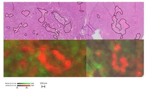 Metabolites Special Issue Spatial Metabolomics
