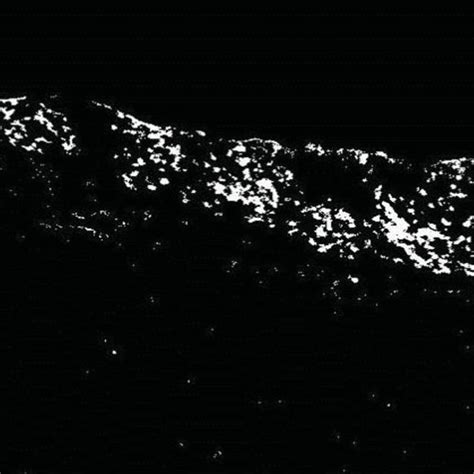 B The Processed Image After Performing Otsu Thresholding On Fig 1 A