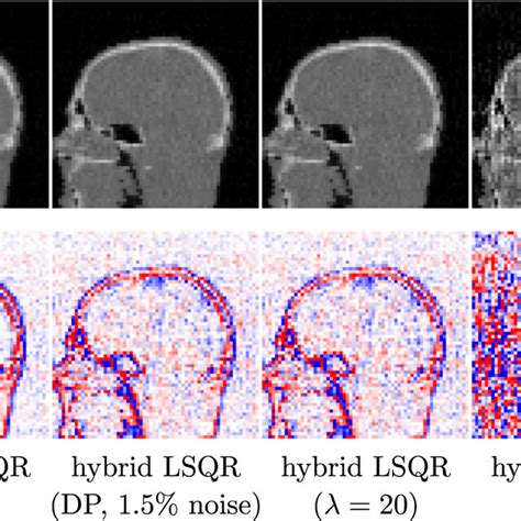 Reconstruction Of Phantom Head Data Using Cgls And Tv Regularized Download Scientific Diagram