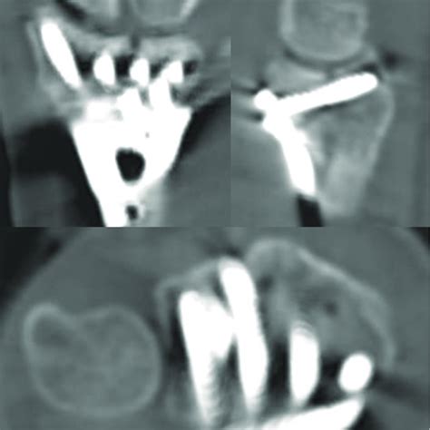 Dose Length Product Dlp Of Ct Download Scientific Diagram