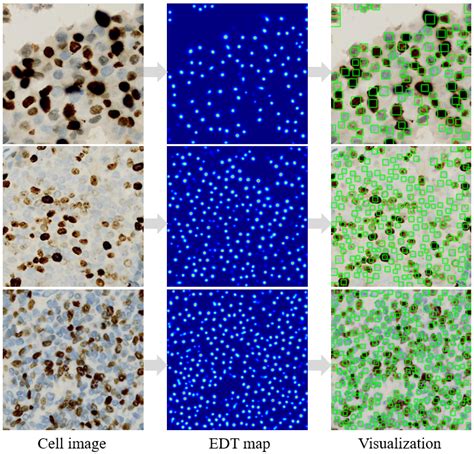 The Effect Of Cell Localization Visualization The First Column Of The Download Scientific