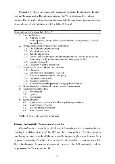 Concentric Vf Defect Can