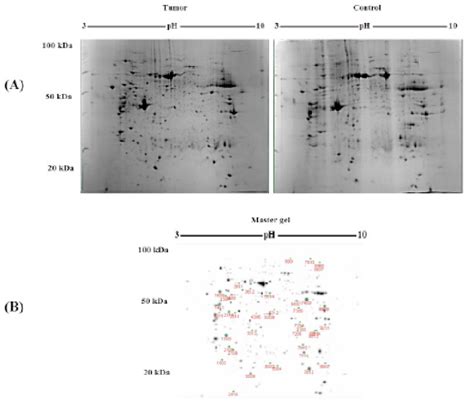 Comparative Tissue Proteome Analysis Of Nsclc Tumor And Matched