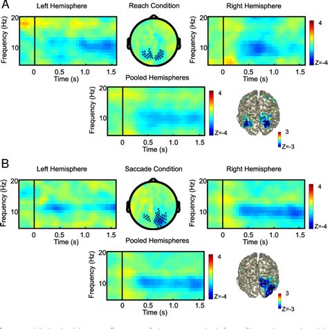 Figure 1 From Neuronal Synchronization In Human Posterior Parietal