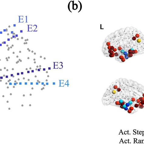 Seizure Propagation Model Exemplary Si Propagation Process For Patient