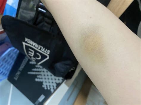 남친한테 맞았아 인스티즈 instiz 익명잡담 카테고리