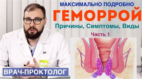 Что Такое Геморрой Фото — Фото