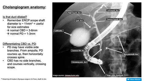 Keith Siau On Twitter Cholangiogram Anatomy Thanks To Tberzin