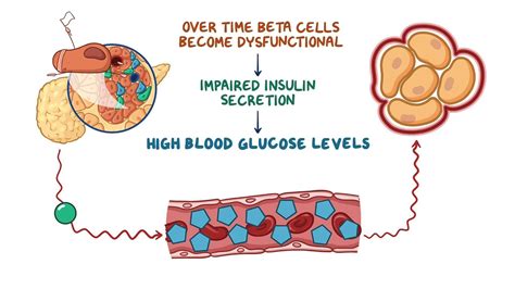 Diabetes Mellitus Type 2 Video And Meaning Osmosis