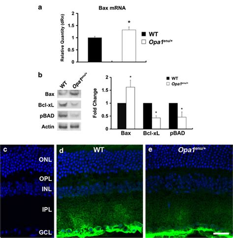 opa1 mutation increases bax expression but decreases bcl xl and pbad