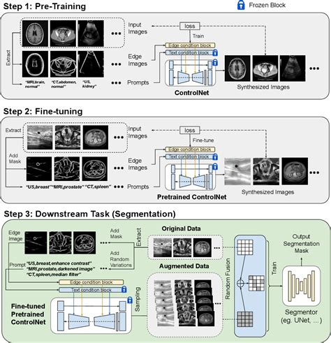 Figure 1 From Diffboost Enhancing Medical Image Segmentation Via Text Guided Diffusion Model