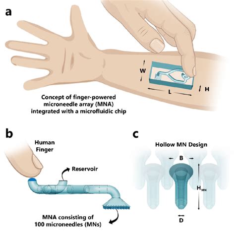 Concept Of Finger Powered Microneedle Array Mna Integrated With A Download Scientific Diagram