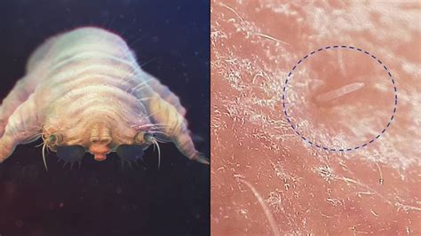 These Mites Have Sex On Your Face And Nipples While You Sleep