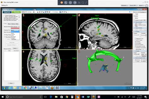 Waypoint™ Navigator Software Fhc