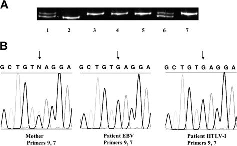 Reversion Mosaicism Of Nemo A Human Androgen Receptor Trinucleotide