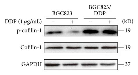 Zjw Induces Dephosphorylation Of P Cofilin 1 In Bgc823ddp And