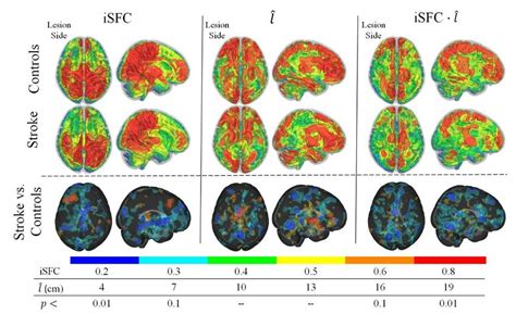 Intrinsic Structurofunctional Correlation Isfc In Stroke And