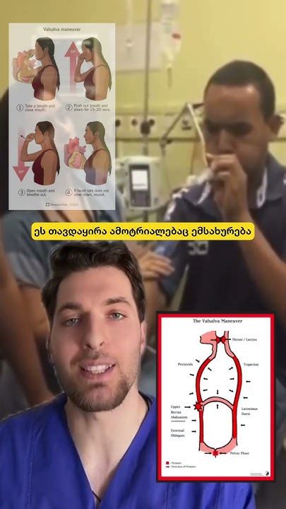 როგორ ეხმარებიან ექიმები პაციენტს არითმიით მედიცინა სამედიცინო ექიმი Youtube