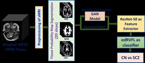 Proposed Method For Scz Diagnosis Using Dl Neuroimaging Informatics