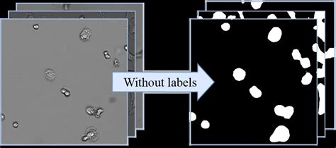 unsupervised cell segmentation by invariant information clustering