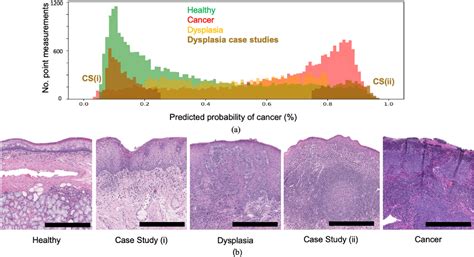 Figure 1 From Intraoperative Margin Assessment In Oral And Oropharyngeal Cancer Using Label Free
