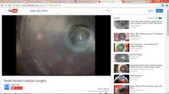 Python Scikit Image Contour Completion Stack Overflow
