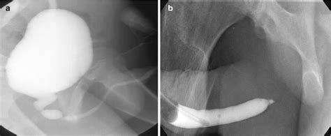 Urethral Imaging Radiology Key