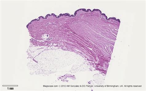 Subcutaneous Tissue Slide